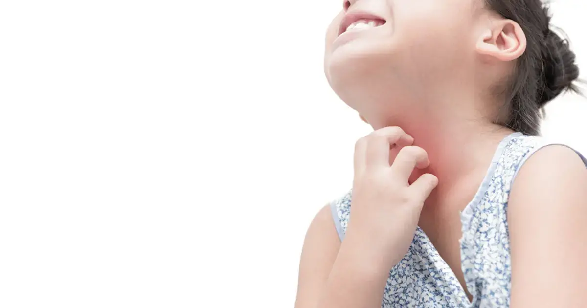 Interview with Dr. Alfred Tam - Allergy in infants and young children ...